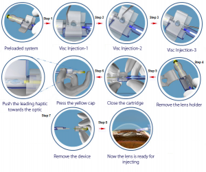 Aurovue EV Preloaded Aspheric IOL | Fizidris Mediq Sdn Bhd